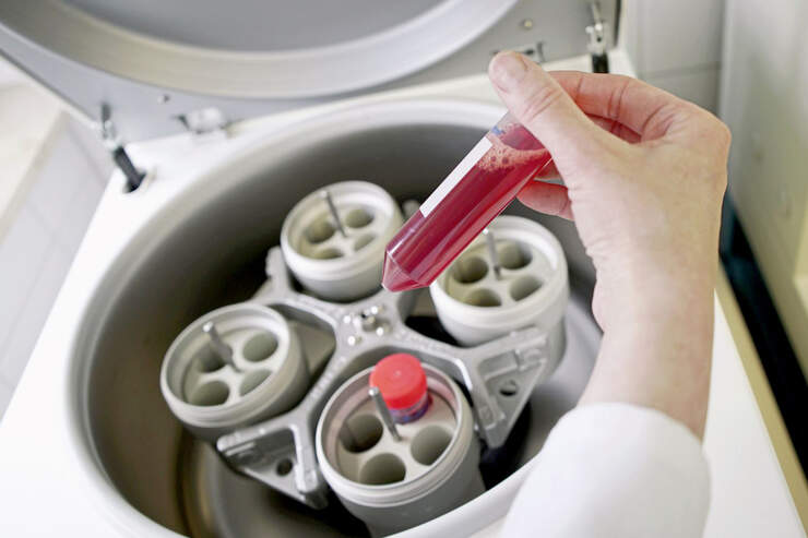 1 Frage, 3 Experten: Was sagen Leberwerte aus? | cavallo.de